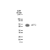 ATF-2 antibody (pAb) | Proteintech
