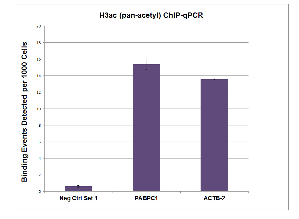 Histone H3ac (pan-acetyl) antibody (pAb) | Proteintech