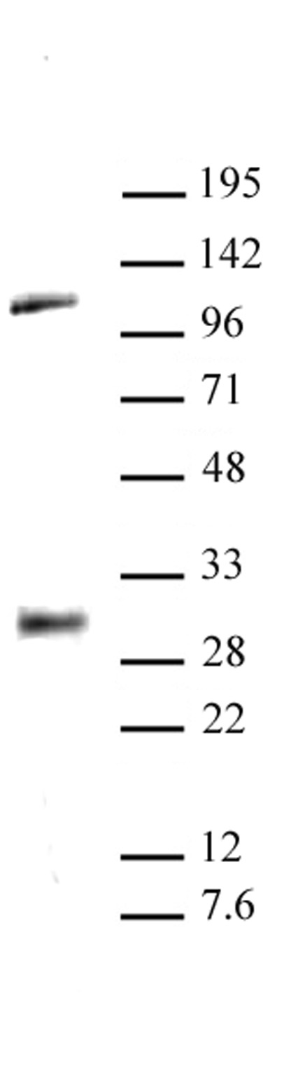 LIN28A antibody (pAb) | Proteintech